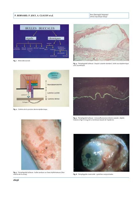 Dermatose