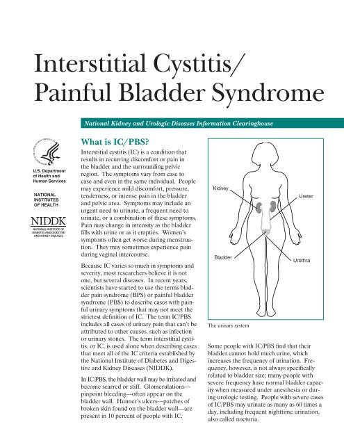 Interstitial Cystitis/Painful Bladder Syndrome - National Kidney and ...