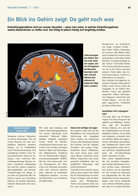 Ein Blick ins Gehirn zeigt: Da geht noch was - beim LCH