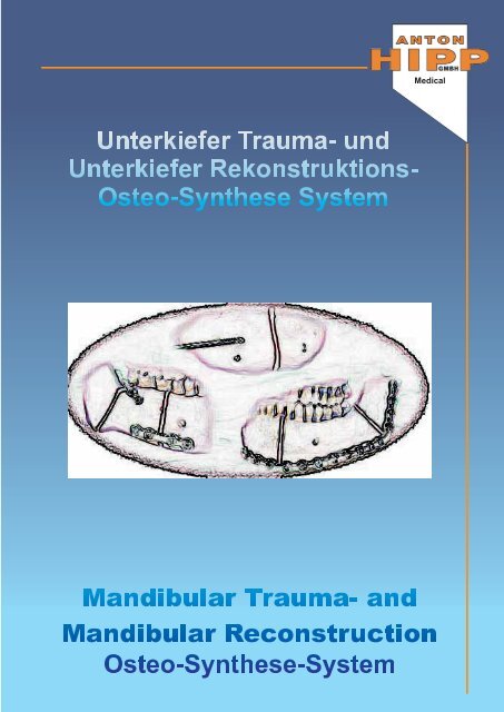 Unterkiefer Rekonstruktion 2,7 S stem mandibular ... - Anton Hipp