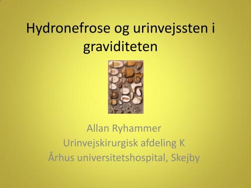 Hydronefrose og urinvejssten i graviditeten