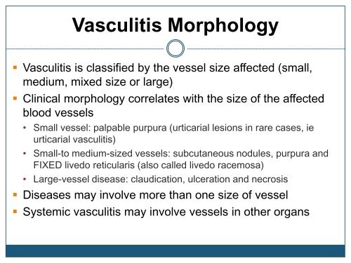 Vasculitis