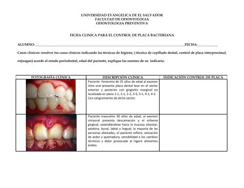 CASOS CONTROL DE PLACA BACTERIANA.pdf