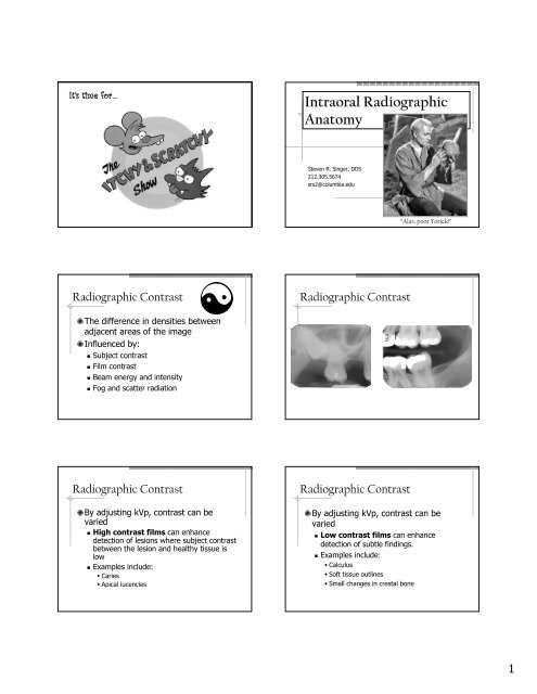 Ppt Normal Radiographic Anatomy Based On Intraoral