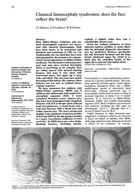 Lissencephaly Symptoms Mutations In α Tubulin Cause Abnormal Neuronal