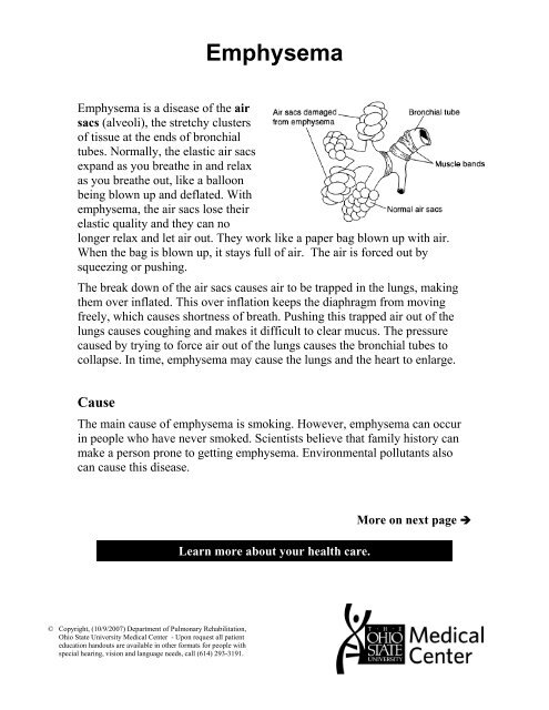 Emphysema - Patient Education Home