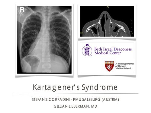 Kartagener's Syndrome