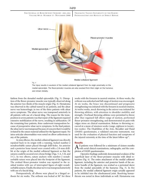 d THE J OURNAL OF B ONE