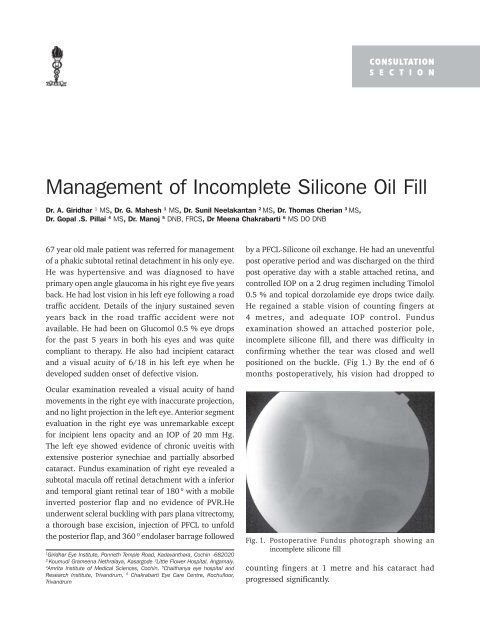 Management of Incomplete Silicone Oil Fill - KSOS