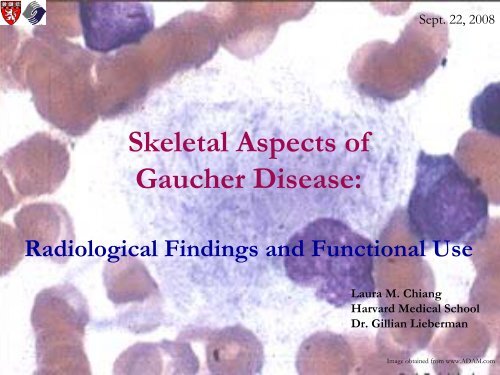 Skeletal Aspects of Gaucher Disease: Radiological Findings and ...