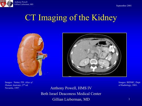 CT Imaging of the Kidney