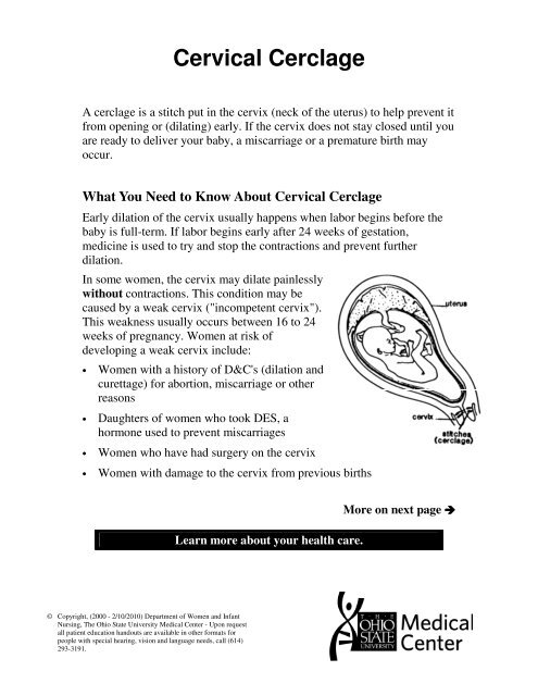 Cervical Cerclage - Patient Education Home