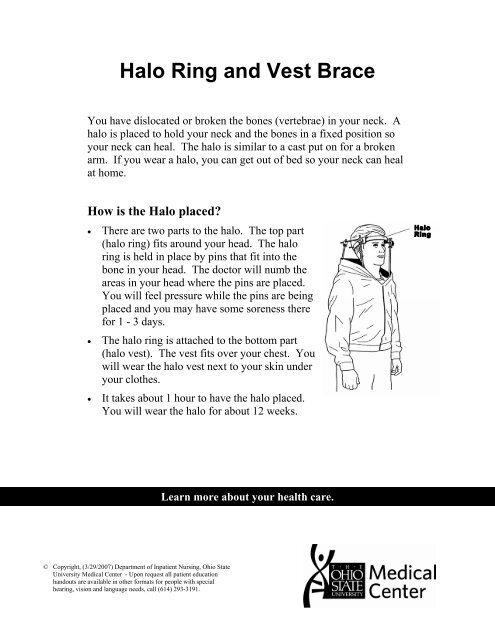 Halo Vest Orthosis