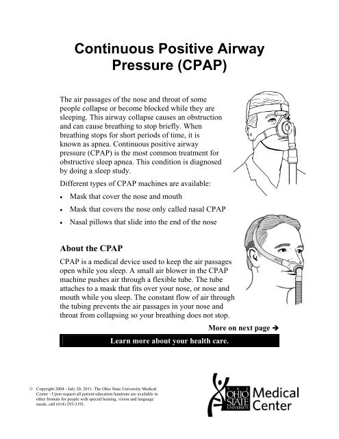 Continuous Positive Airway Pressure (CPAP) - Patient Education ...
