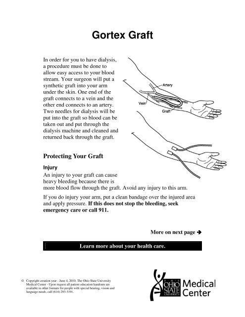 Gortex Graft (Dialysis) - Patient Education Home