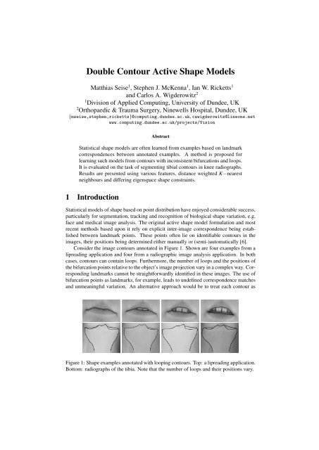 Double Contour Active Shape Models - Oxford Brookes University