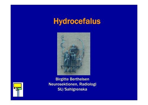 Hydrocefalus