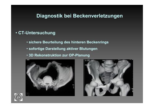 Diagnostik bei Beckenverl