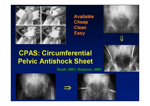 Polytrauma: hier Becken B