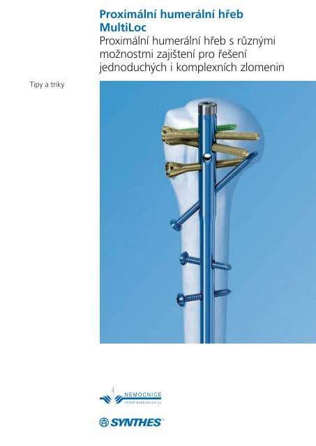 MultiLoc Tipy a triky - Synthes