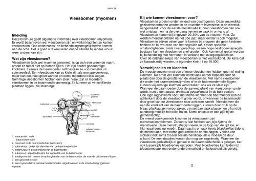 Vleesbomen (myomen) - Rivas