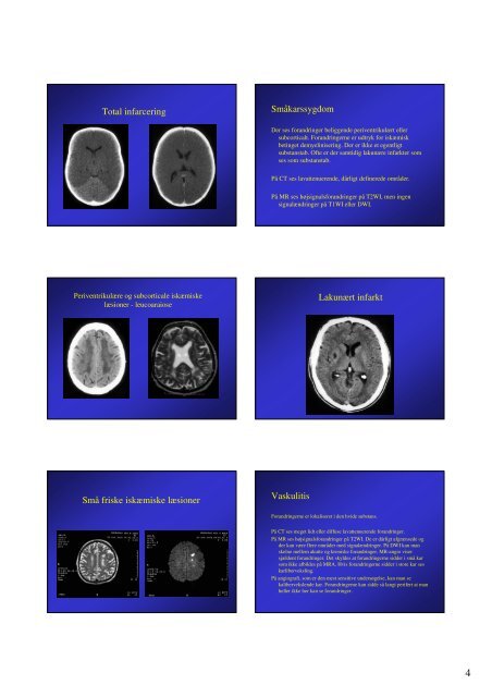 Total infarcering Periven