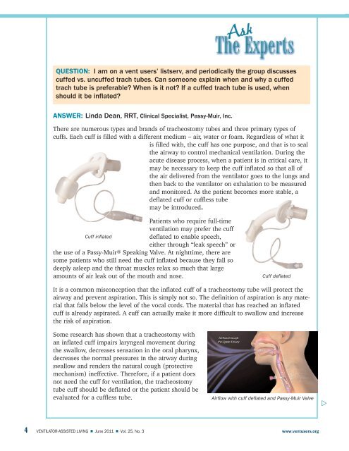 Cuffed Tracheostomy Tube Vs Uncuffed