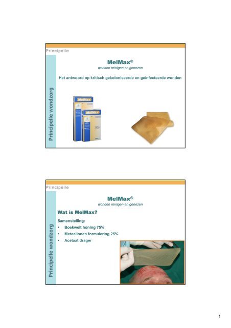 MelMax® MelMax® - Principelle