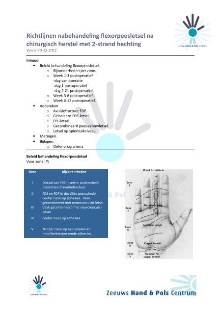 flexor pees letsel - Zeeuws Hand & Pols Centrum