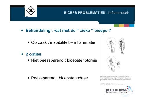 Behandeling Conservatief