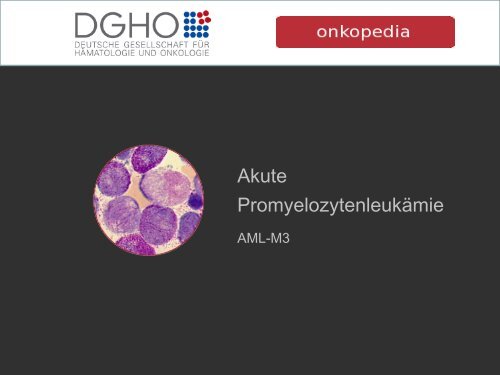 Akute Promyelozytäre Leukämie – AML M3 - Onkopedia