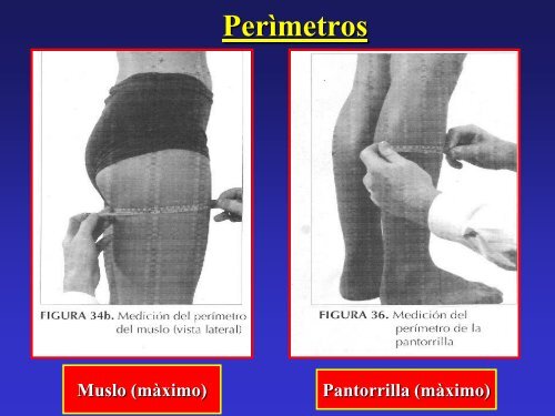 Muslo (màximo) Perìmetr Muslo (màximo) Perìmetr