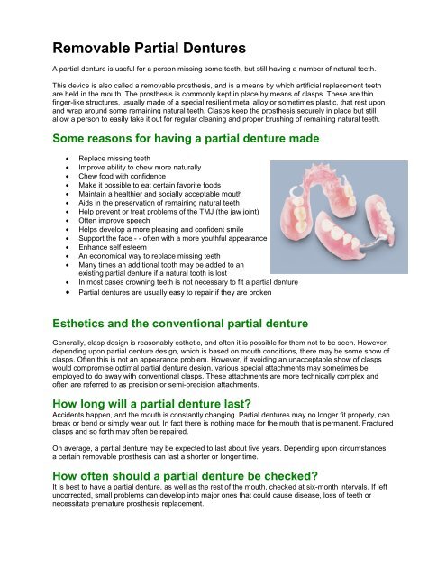 Removable Partial Dentures - Forest View Dental