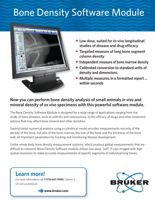 Bone density software module sell sheet - Bruker