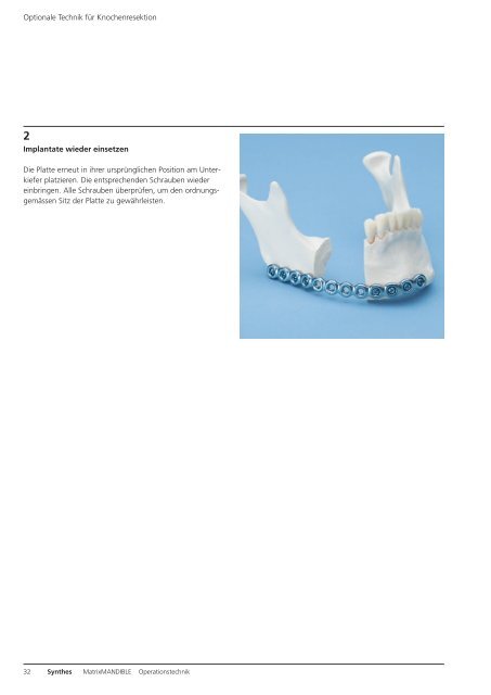 Optionale Technik für Kn