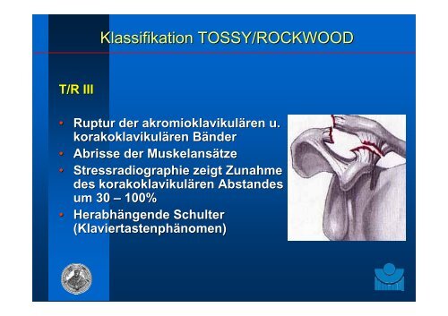 Klassifikation TOSSY/ROCK