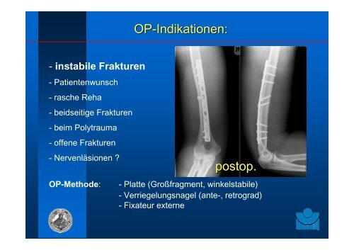 OP-Indikationen: - instab