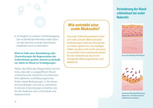 Was ist eine orale Mukosi