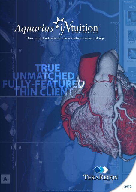 Aquarius iNtuition - TeraRecon