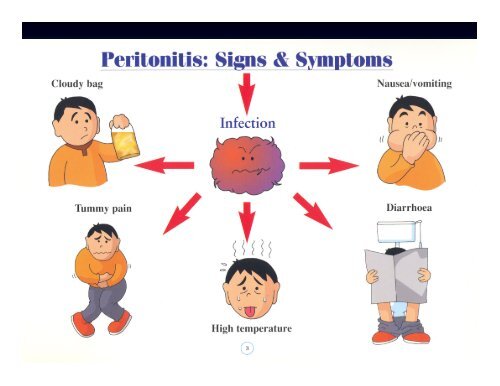 Peritonitis Management in Children on PD Peritonitis Management ...