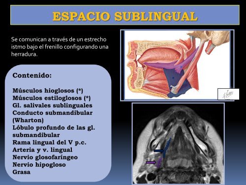 ESPACIO SUBLINGUAL El