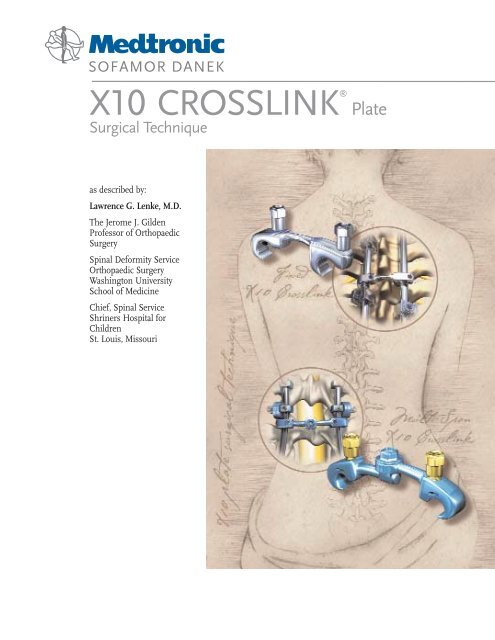 X10 Crosslink ST - MT Ortho