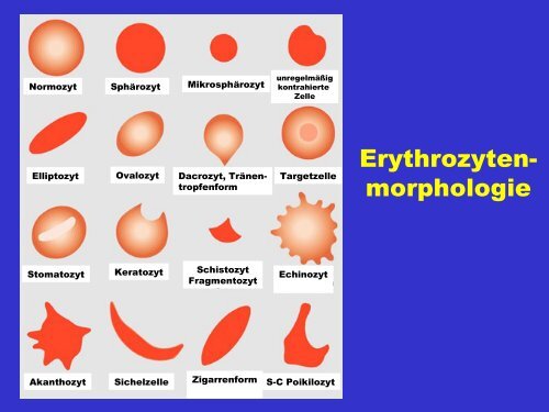 Erythrozytenmorphologie