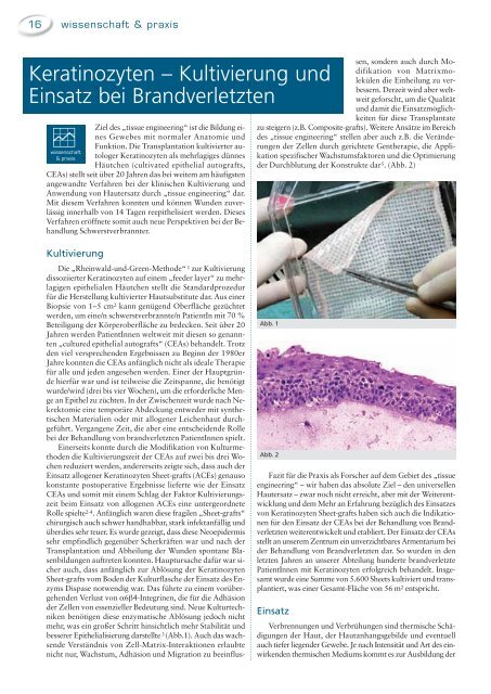 Keratinozyten – Kultivierung und Einsatz bei ... - biomed-austria