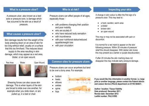 What is a pressure ulcer?