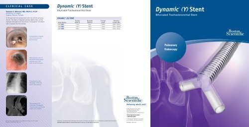 Dynamicâ ¢ (Y) Stent - Boston Scientific