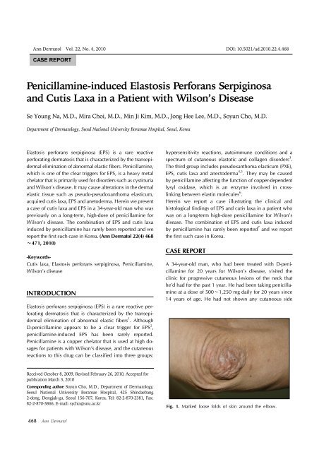 Penicillamine-induced Elastosis Perforans Serpiginosa and Cutis ...
