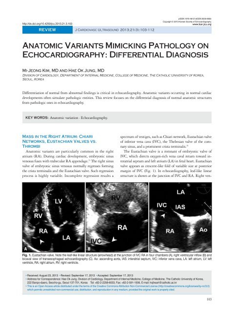 Anatomic Variants Mimicking Pathology on Echocardiography ...