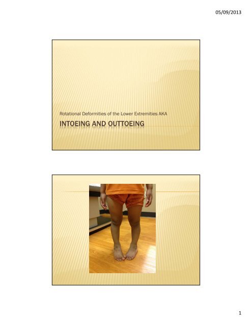 intoeing and outtoeing - School of Medicine - University of Missouri