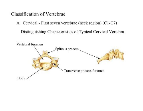 Classification of